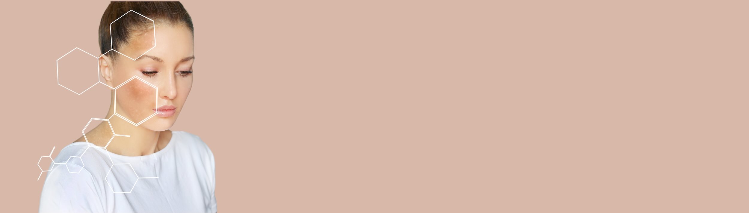 Traitement Tâches Pigmentaires | Epilium & Skin Paris